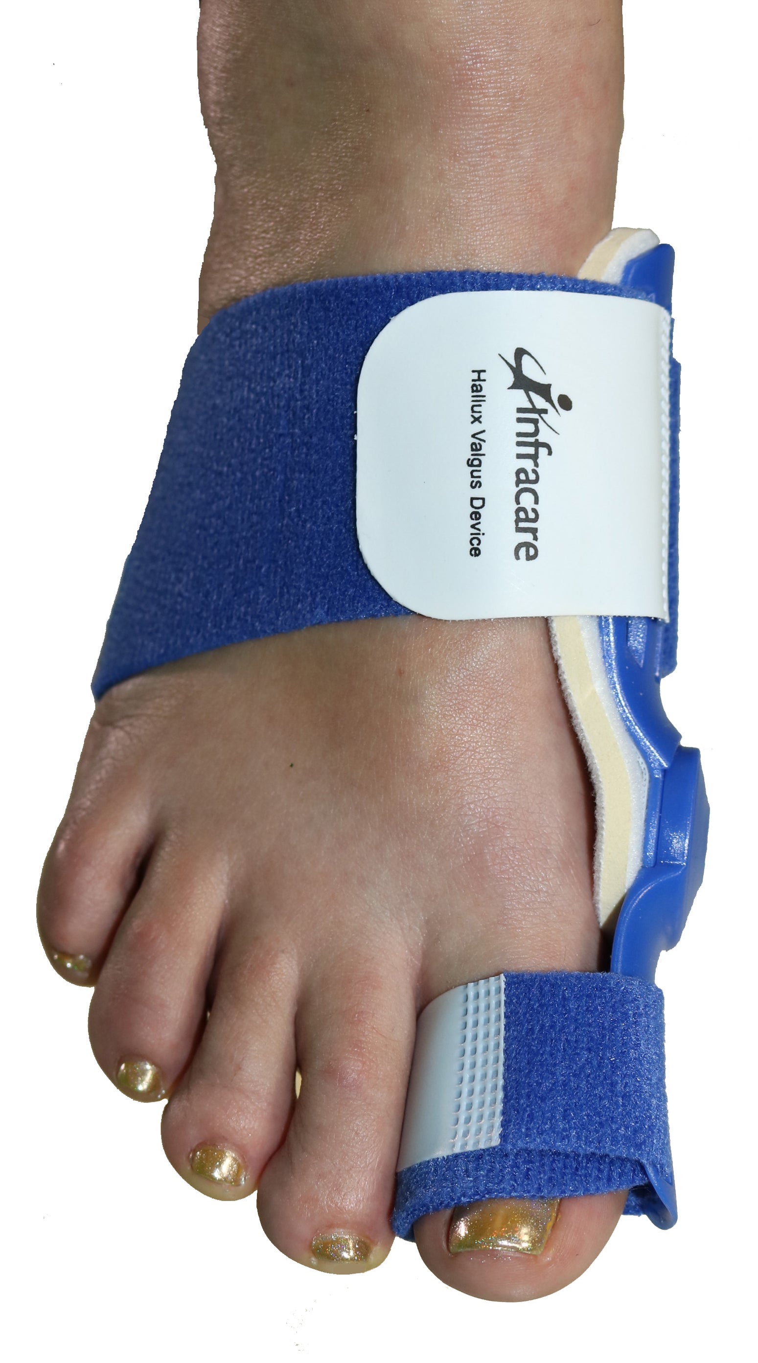 Bunion Walkable Night Splint — MEDLEE